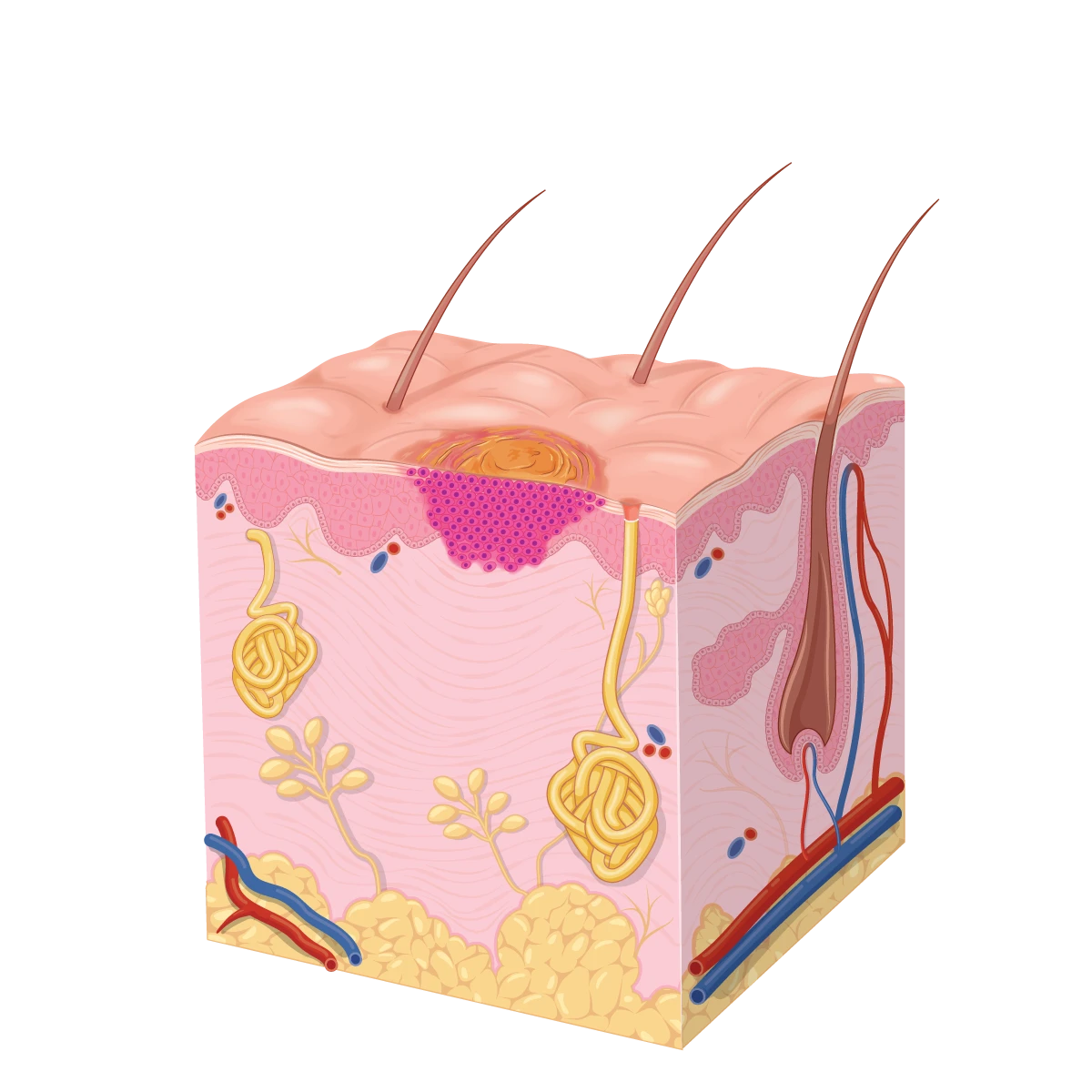 SCC in Situ: Key Information