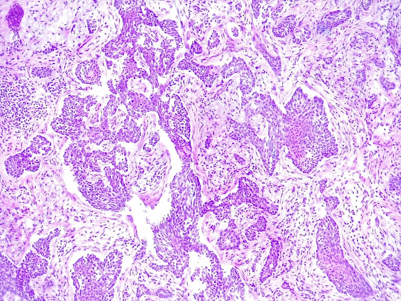 Inside a Mohs Surgeon’s Microscope: What They See