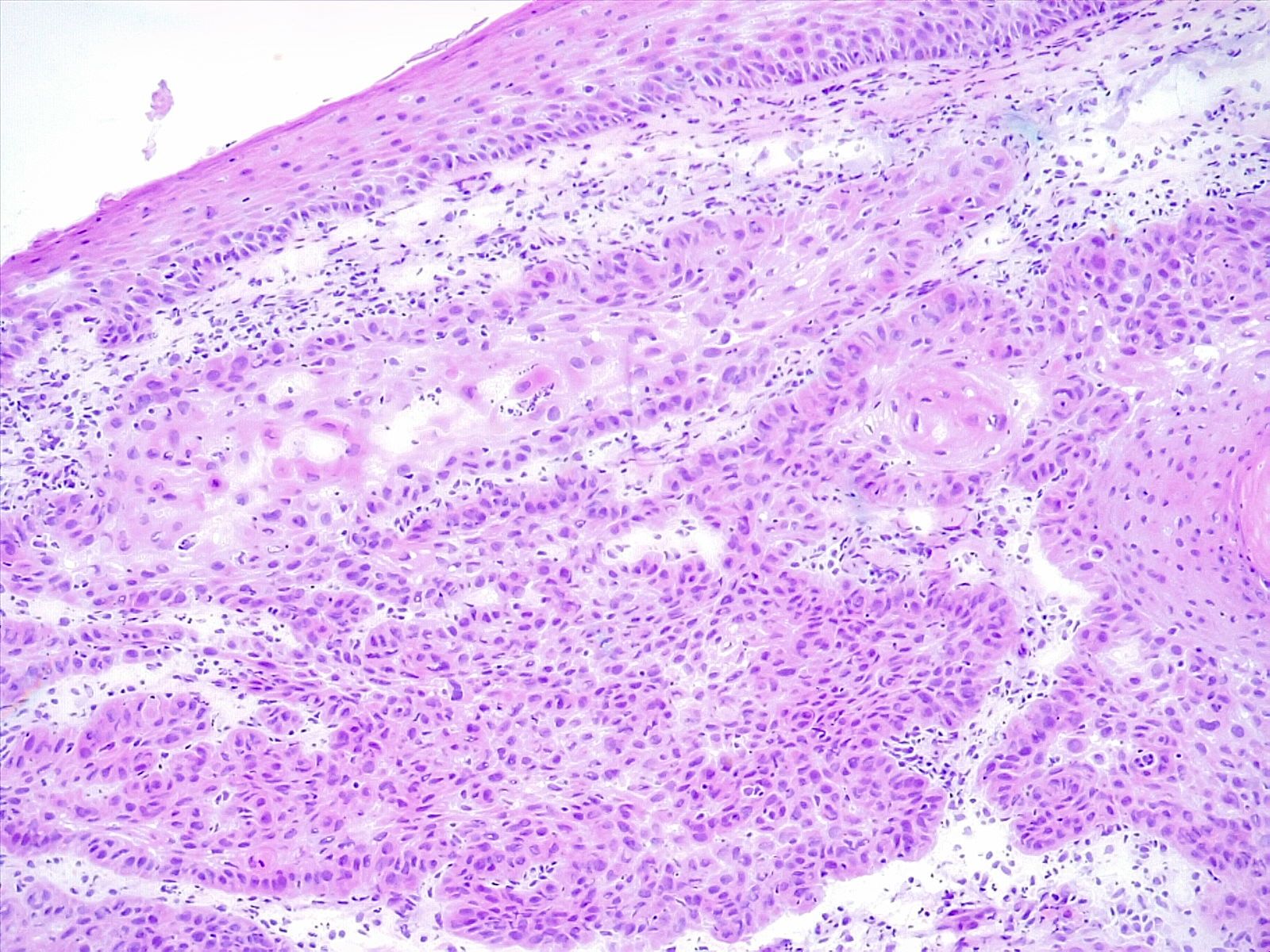 Inside a Mohs Surgeon’s Microscope: What They See