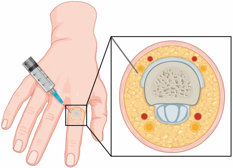 Guide to Local Anaesthetic - Skintel