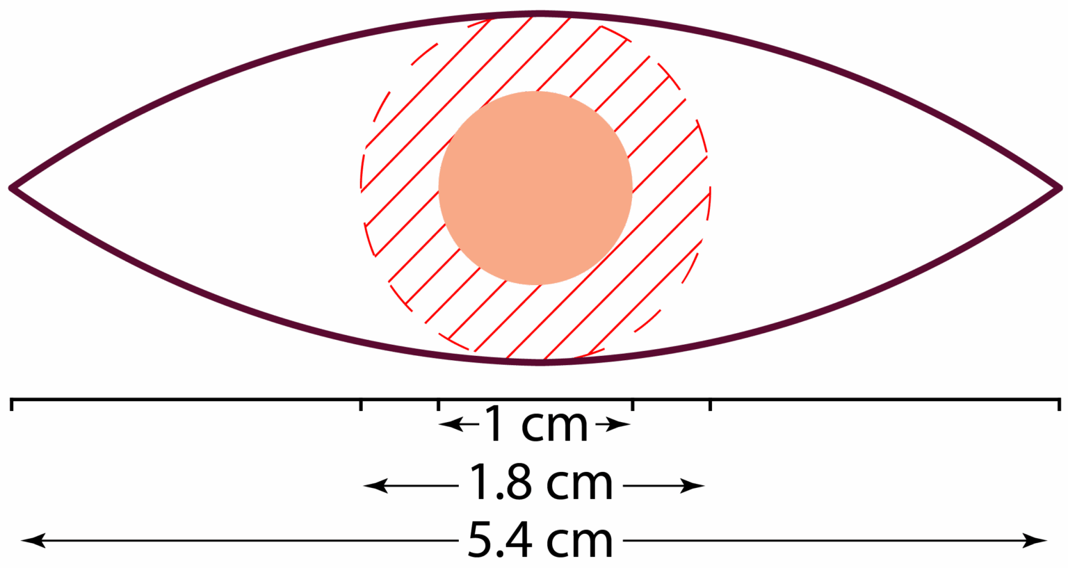 Basal Cell Carcinoma: The Definitive Guide - Skintel